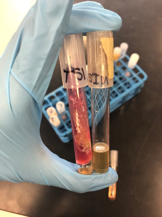 Solved I think my bacteria is enterobacter aerogenes/ k | Chegg.com