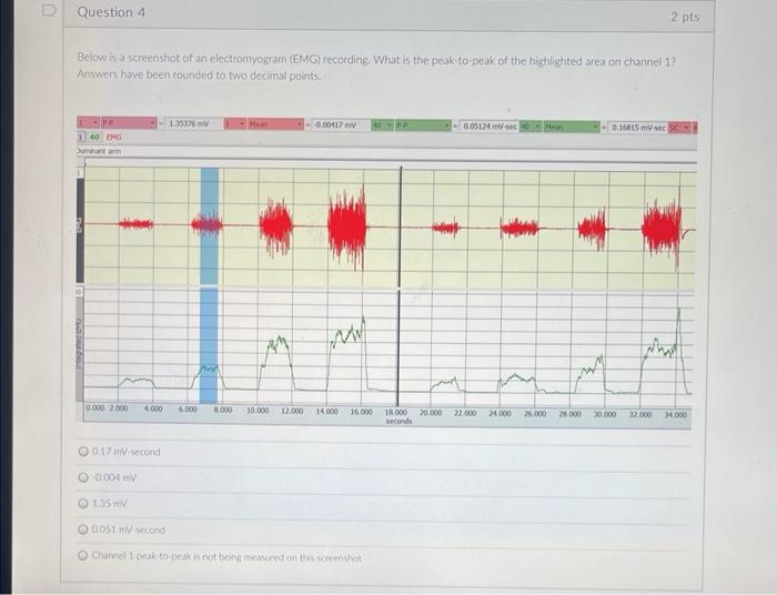Solved Below is a screenshot of an electromyogram (EMG) | Chegg.com
