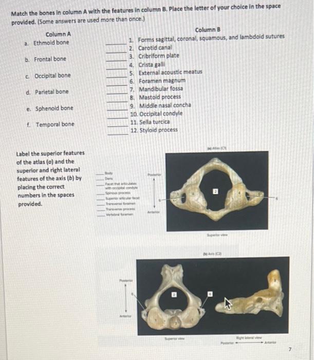 Match the bones in column A with the features in | Chegg.com