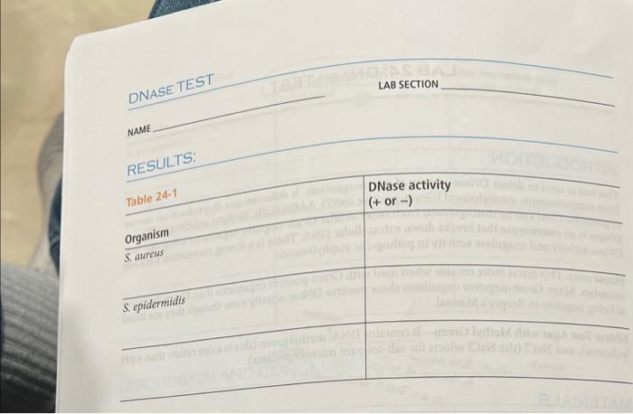 LAB SECTION NAME RESULTS: Table 24-1 DNase activity | Chegg.com