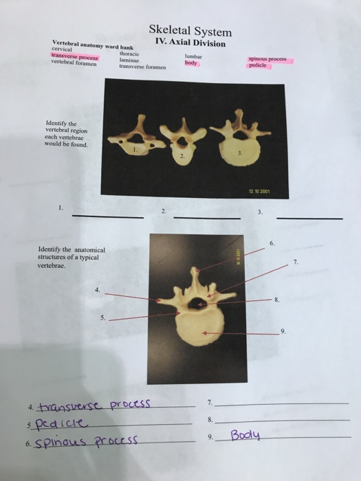 Solved Skeletal System IV. Axial Division Vertebral anatomy | Chegg.com