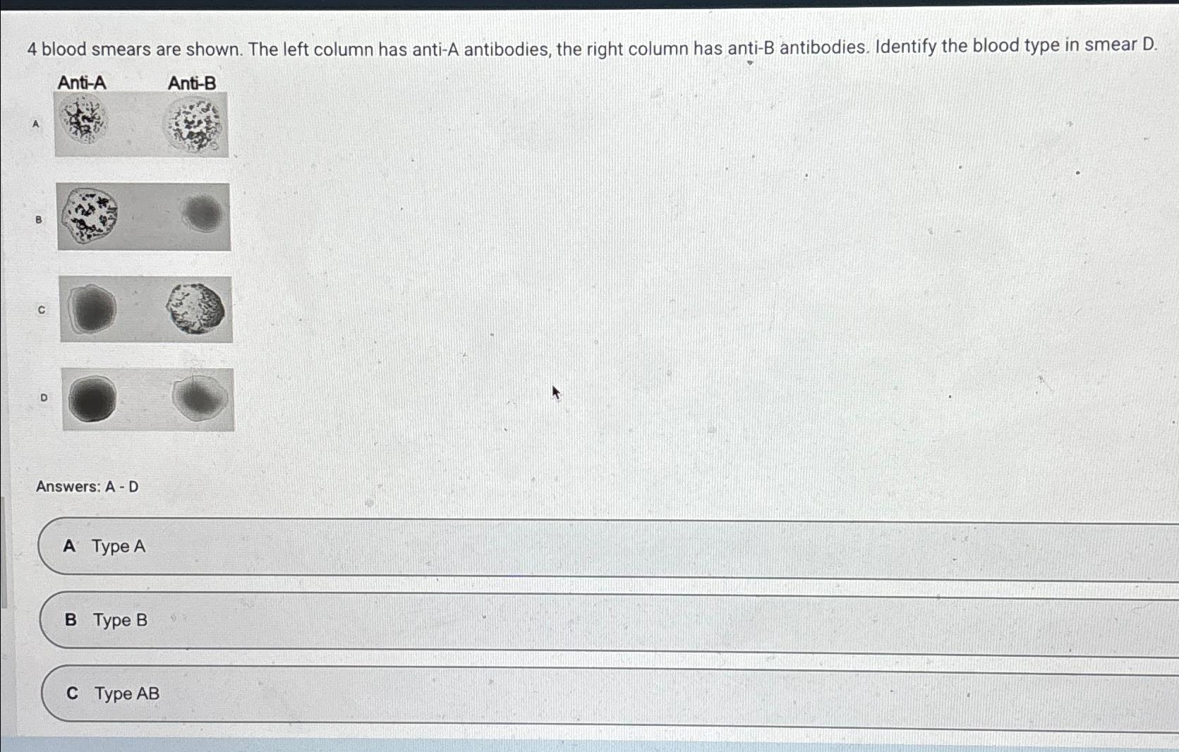 Solved 4 ﻿blood smears are shown. The left column has anti-A | Chegg.com