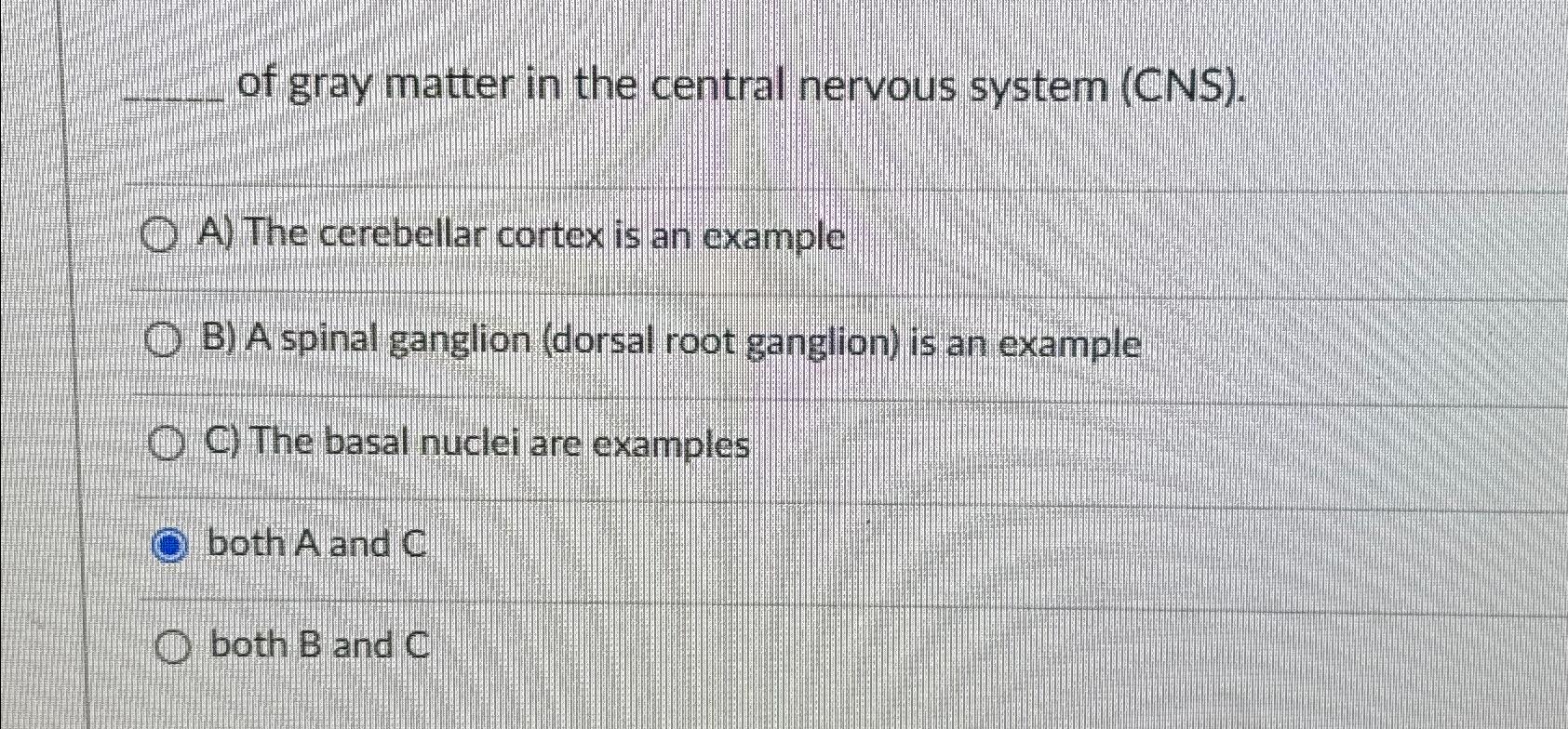 Solved of gray matter in the central nervous system (CNS).A) | Chegg.com