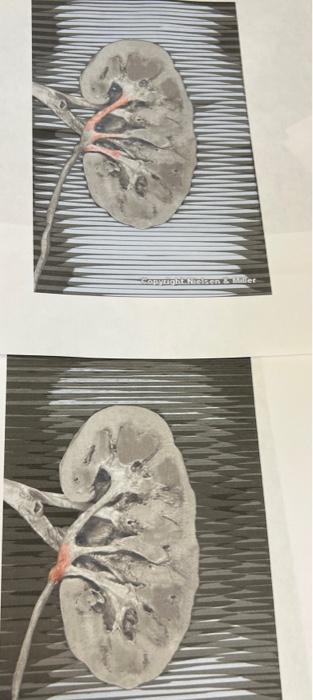 Solved Identify the highlighted structure | Chegg.com