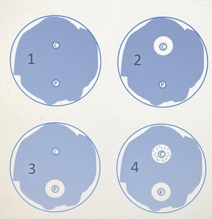 Your lab partner set up plate 4 by spreading a pure | Chegg.com