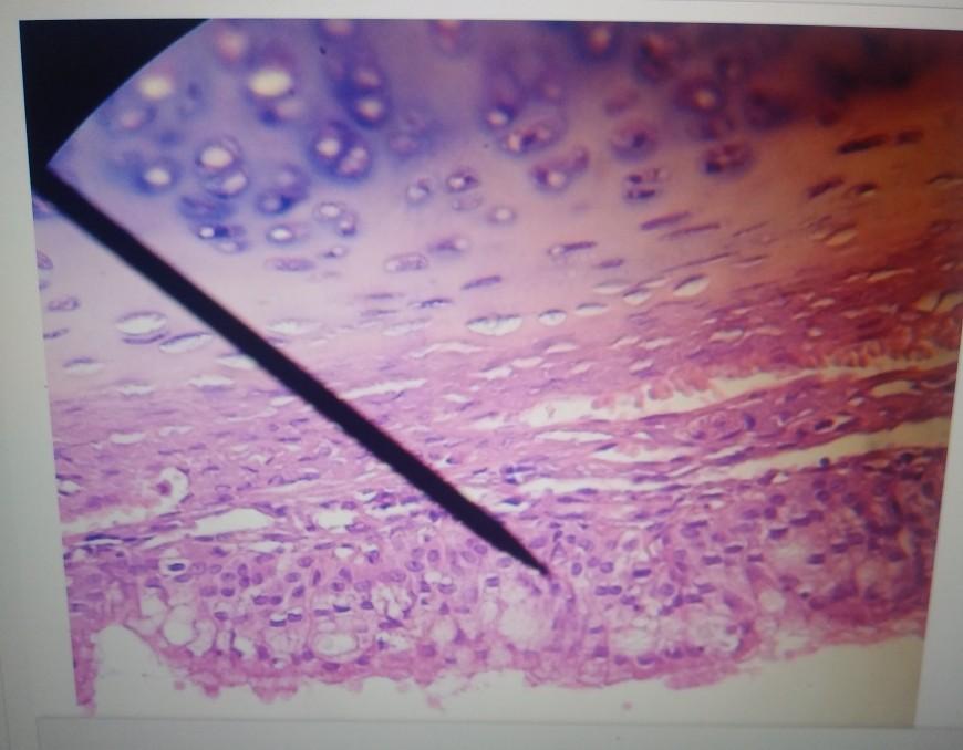 Solved Identify the type of cell at the tip of the pointer | Chegg.com