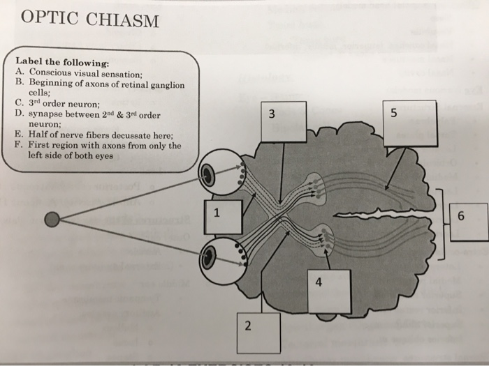 Solved OPTIC CHIASM Label the following: A. Conscious visual | Chegg.com
