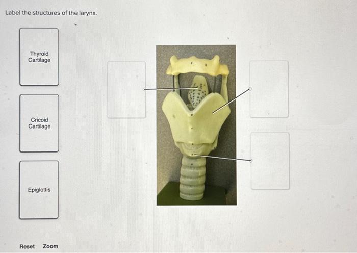 Solved Label the structures of the larynx. | Chegg.com