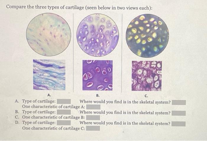 Solved Compare the three types of cartilage (seen below in | Chegg.com