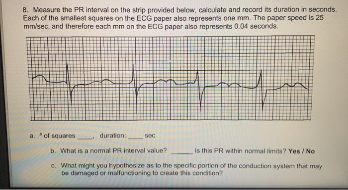 Solved 8. Measure the PR interval on the strip provided | Chegg.com