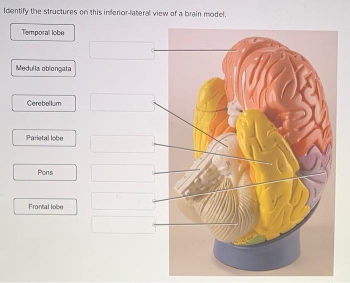 Solved Identify the structures on this inferior-lateral view | Chegg.com