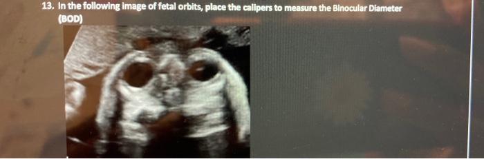 Solved 12. In the following image of fetal orbits, place the | Chegg.com