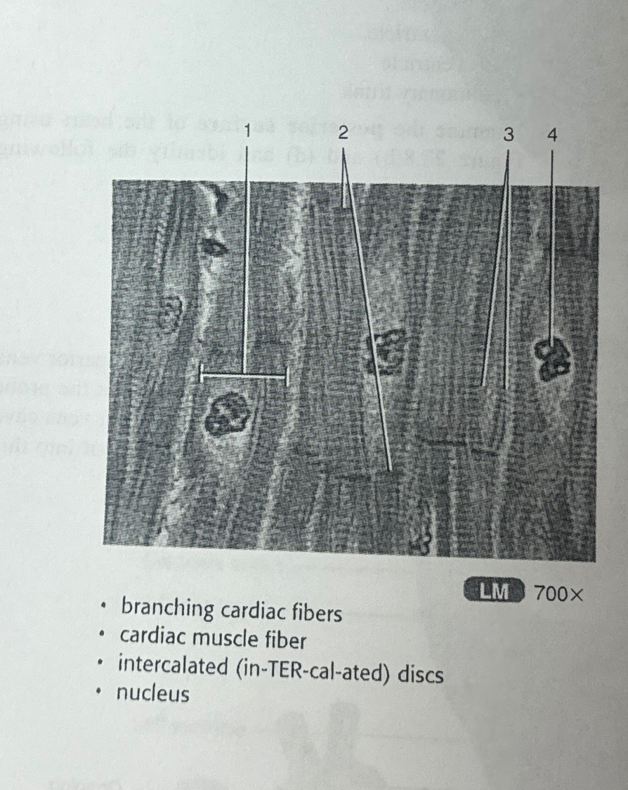 Solved Label the photomicrograph of cardiac muscle fibers | Chegg.com
