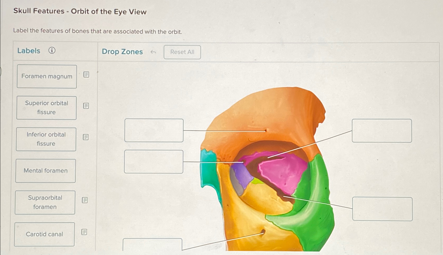 Solved Skull Features - ﻿Orbit of the Eye ViewLabel the | Chegg.com