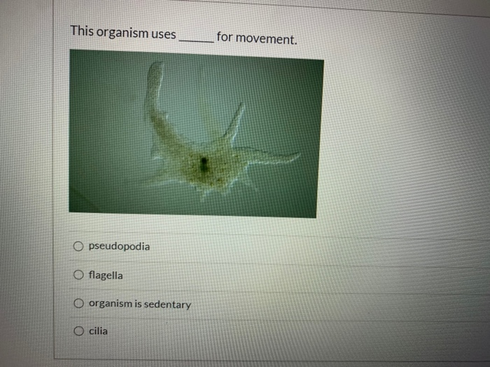 Solved The yellow protist seen in the image is considered | Chegg.com