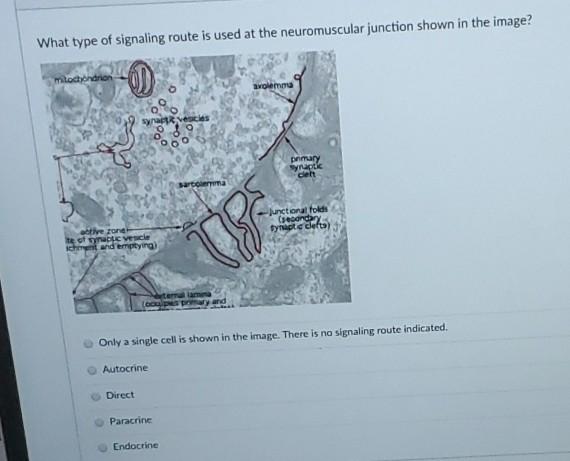 Solved What type of signaling route is used at the | Chegg.com