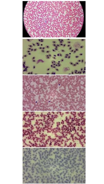 SLIDES: 1. Human Blood 2. Frog Blood 3. Human | Chegg.com