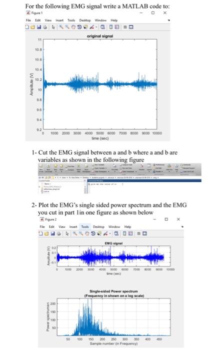 For The Following Emg Signal Write A Matlab Code To