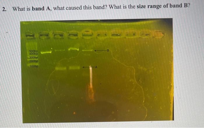 Solved What is band A, what caused this band? What is the | Chegg.com
