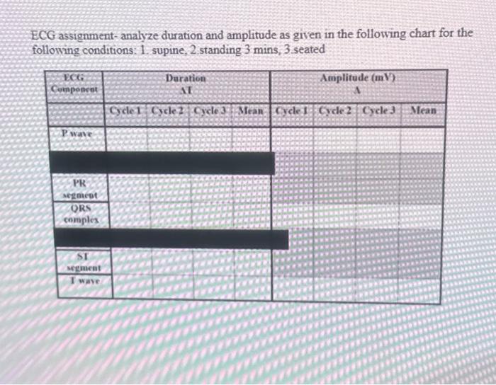 Solved Ecg Assignment Analyze Duration And Amplitude As