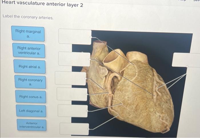 Solved Heart vasculature anterior layer 2 Label the coronary | Chegg.com