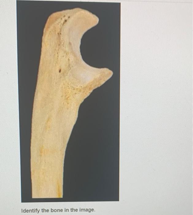 Solved Identify the highlighted structures. Name the type | Chegg.com