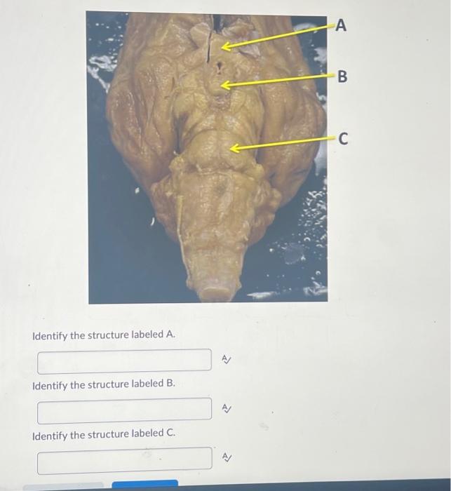 Solved Identify the structure labeled A. Identify the | Chegg.com