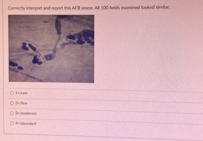 Solved Correctly interpret and report this AFB smear. All | Chegg.com