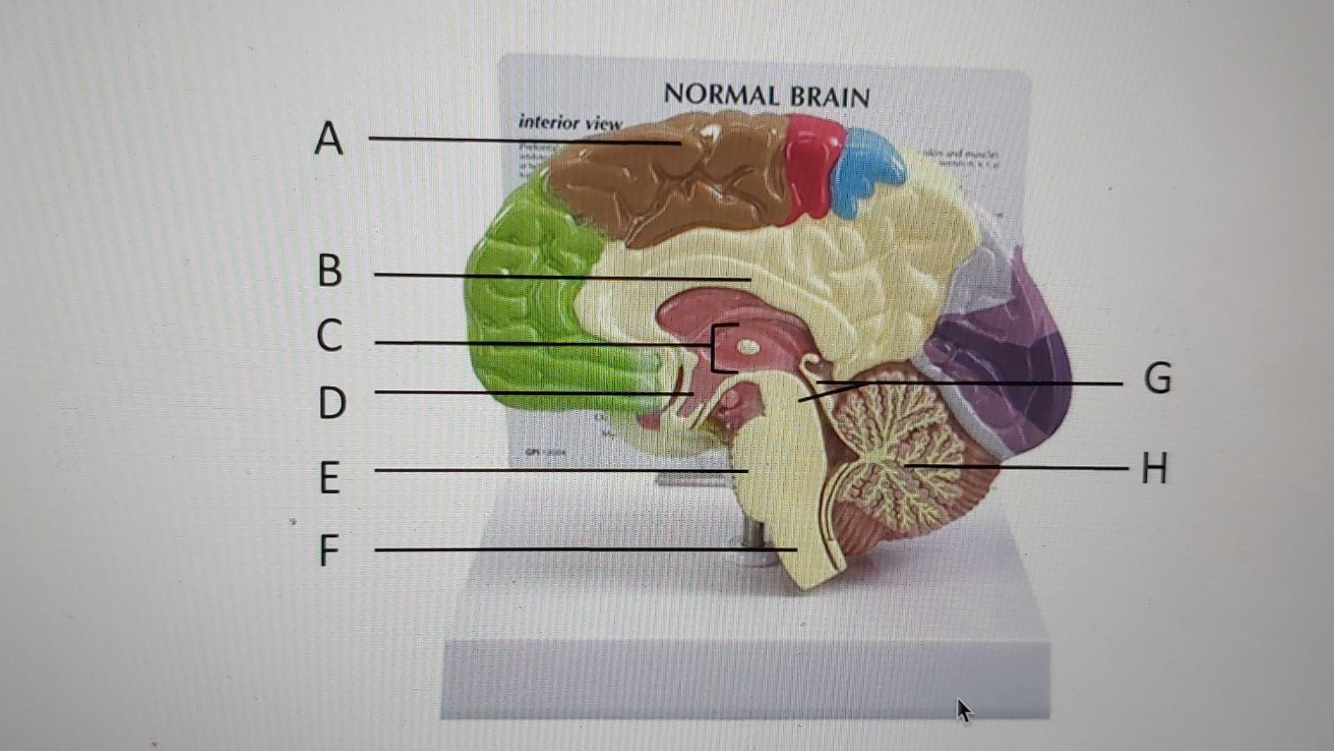 Solved NORMAL BRAIN interior view A- B C G ம ப 0 ப ட D E H H | Chegg.com
