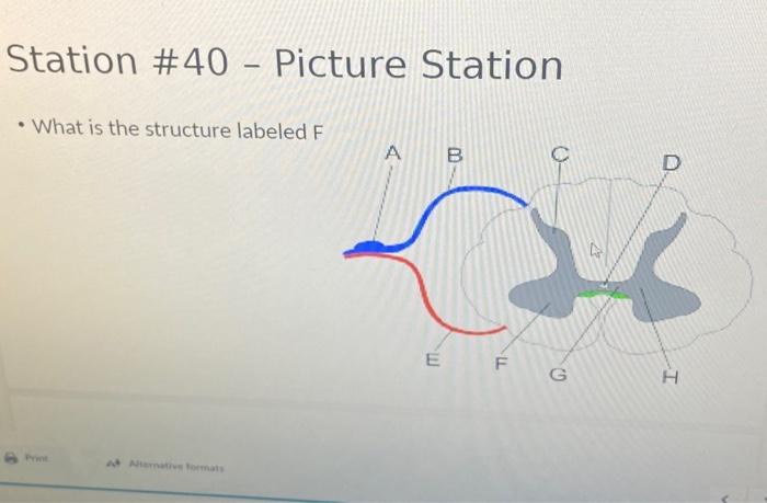 Solved Station \#41 - Description Station - 1 contain axons | Chegg.com