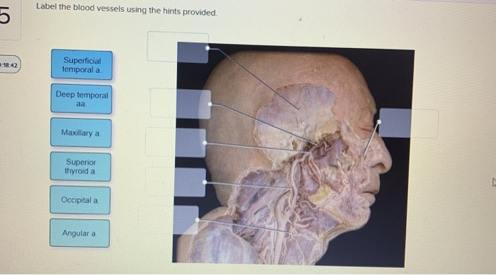 Solved Label the blood vessels using the hints provided 5 | Chegg.com