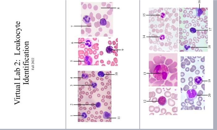 Virtual Lab 2: Leukocyte Identification Fall 2022 | Chegg.com