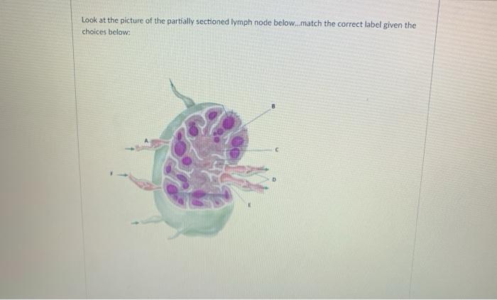 Solved Look at the picture of the partially sectioned lymph | Chegg.com