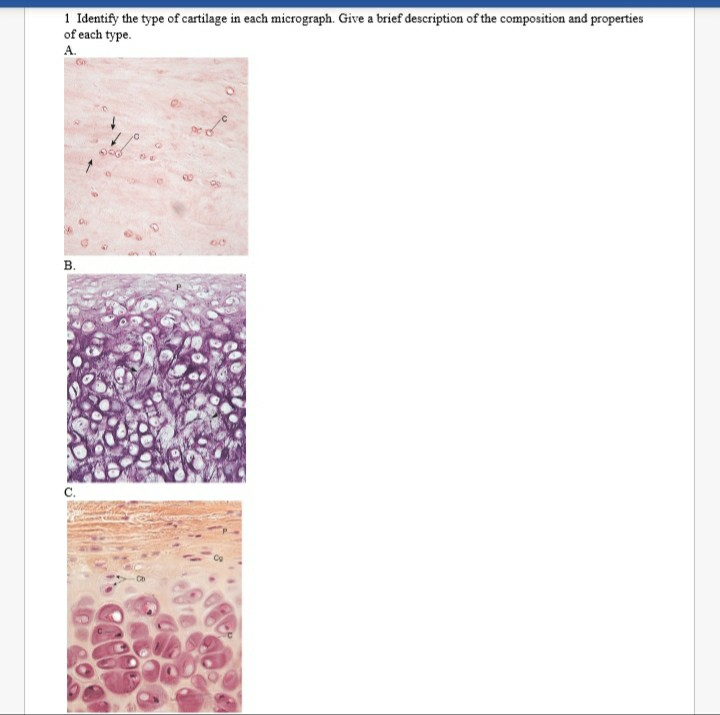 Solved 1 Identify the type of cartilage in each micrograph. | Chegg.com