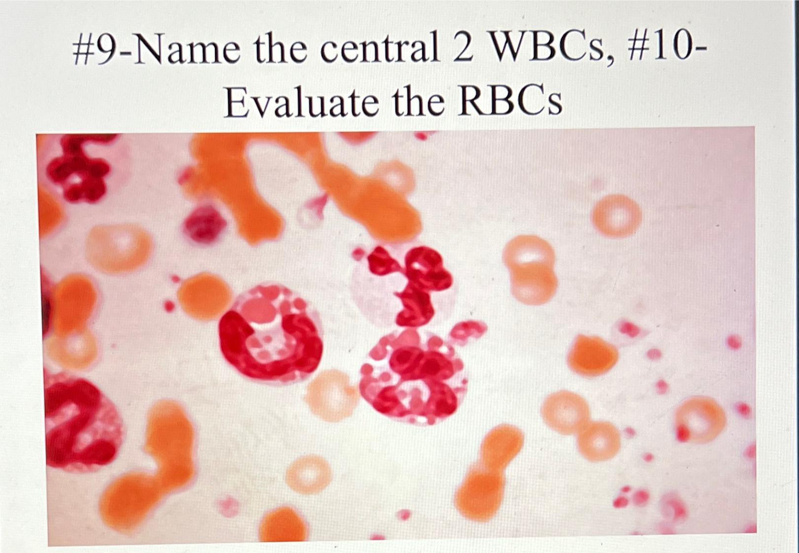 Solved #9-Name the central 2 ﻿WBCs, ﻿#10Evaluate the RBCs | Chegg.com