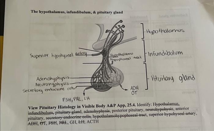 Solved The hypothalamus, infundibulum, \& pituitary gland | Chegg.com