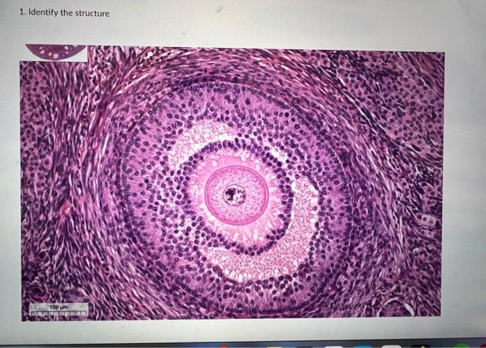 Solved 1. Identify the structure | Chegg.com Solved 1. Identify the structure | Chegg.com