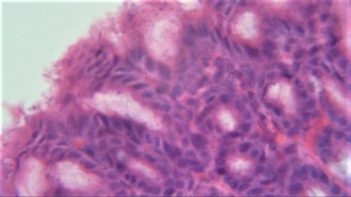 LABEL A SIMPLE COLUMNAR CELL, FOVEOLAR CELL, GASTRIC | Chegg.com