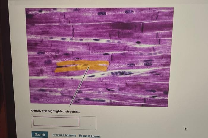 Solved Idenury the highlighted fiber type. Identify the | Chegg.com