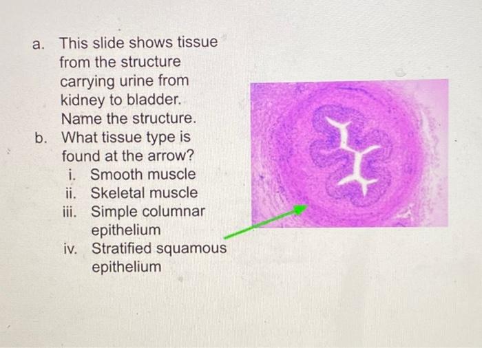 Solved a. This slide shows tissue from the structure | Chegg.com