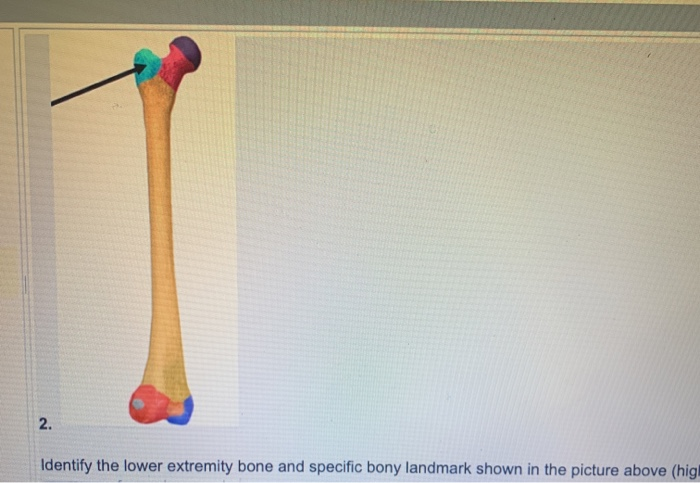 Solved Identify the lower extremity bone and specific bony | Chegg.com