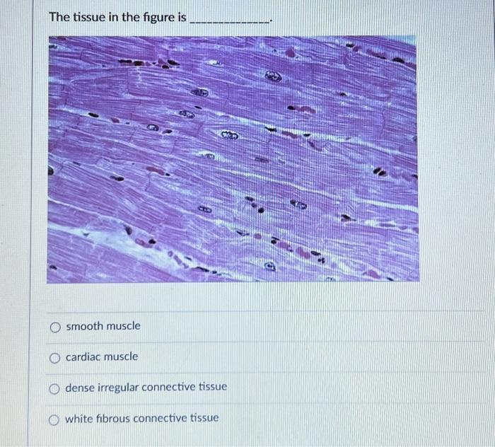 Solved The tissue in the figure is smooth muscle cardiac | Chegg.com