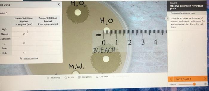 Solved ab Data х Observe growth on vulgaris plate ase 5 Zone | Chegg.com