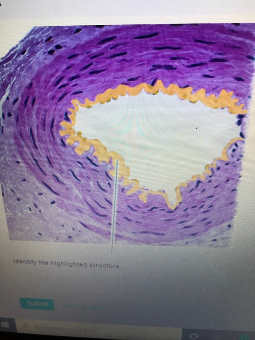 Solved Identify the highlighted structure, | Chegg.com
