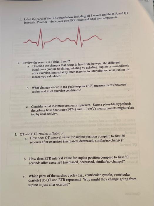 Solved 1. Label the parts of the ECG trace below including | Chegg.com