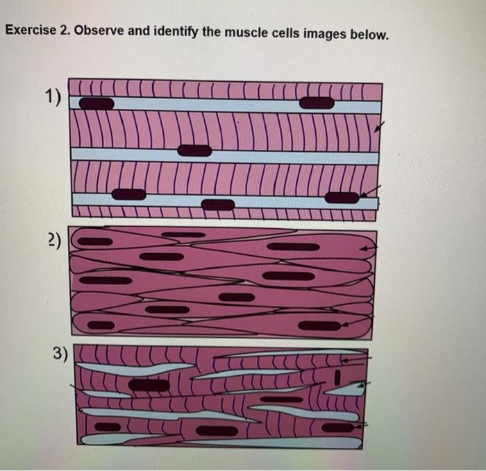 Solved Exercise 2. Observe and identify the muscle cells | Chegg.com