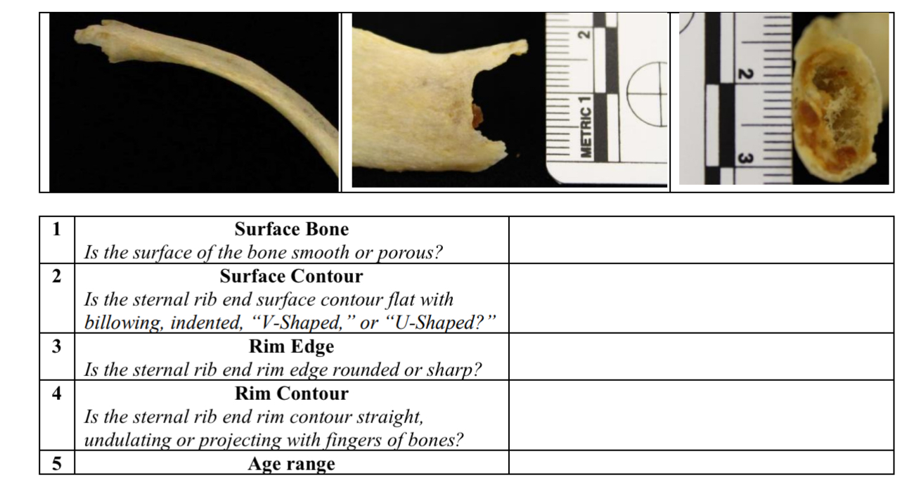 Solved \table[[1,\table[[Surface Bone],[Is the surface of | Chegg.com