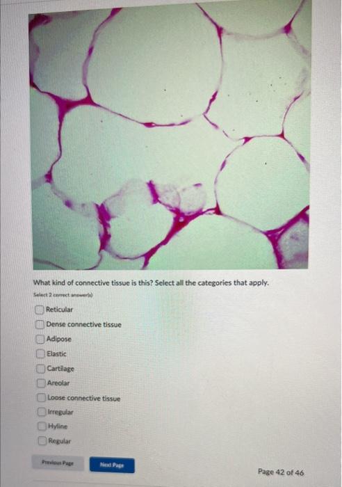 Solved What kind of connective tissue is this? Select all | Chegg.com