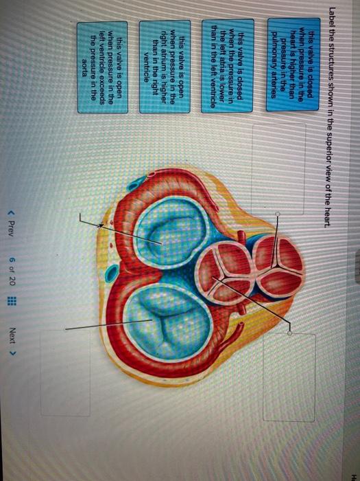 Solved Label the structures shown in the superior view of | Chegg.com