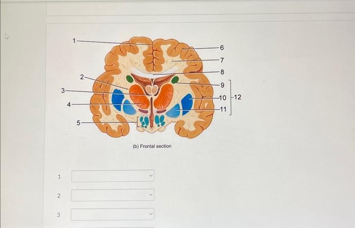 Solved (b) Frontal section 1 2 3 | Chegg.com
